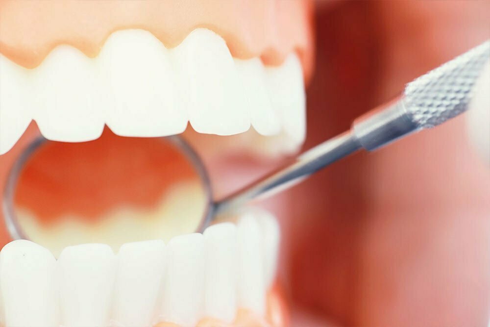 Queen Dental Dental Center - Expensive Life Style of Riches